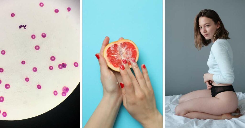 Candidose Vaginale Causes Symptômes Et Que Dois Je Faire Si Jen Ai